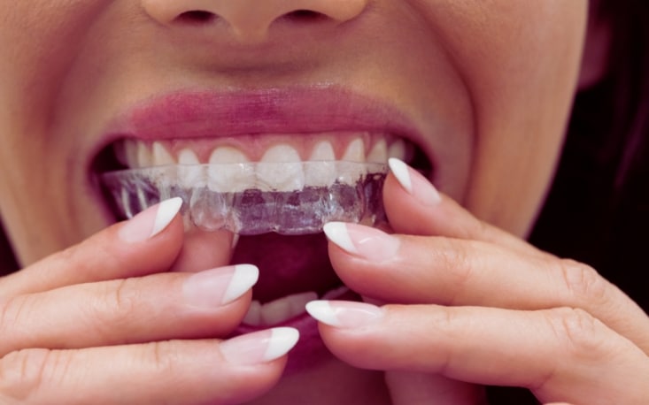 Drinking Coffee with Invisalign? Avoid These Mistakes